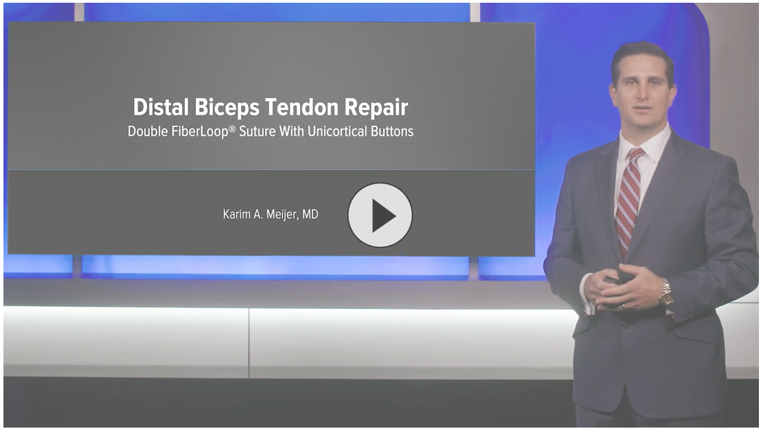 Surgery Videos | Two-Incision Distal Biceps Repair Parker, CO